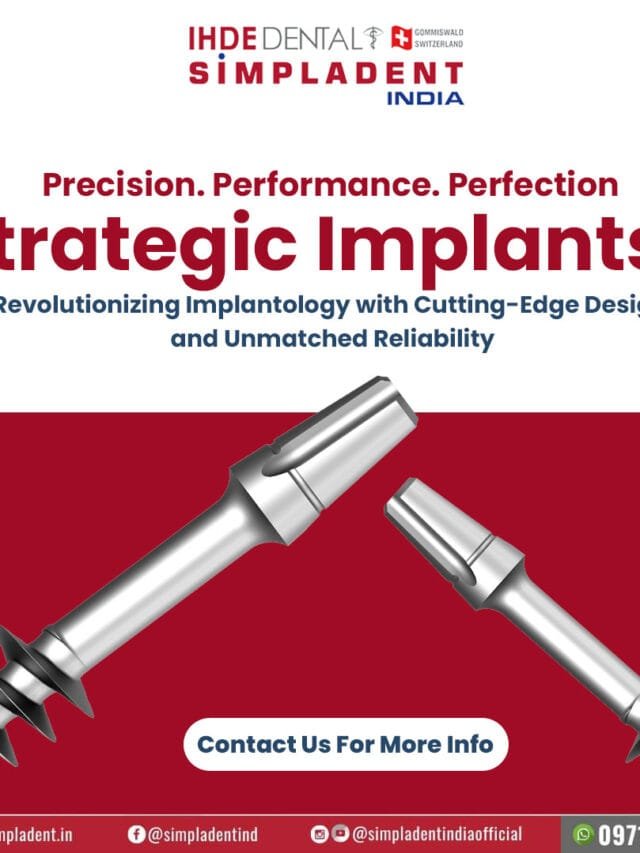 Strategic® Implants: The Game-Changer In Modern Tooth Replacement ...